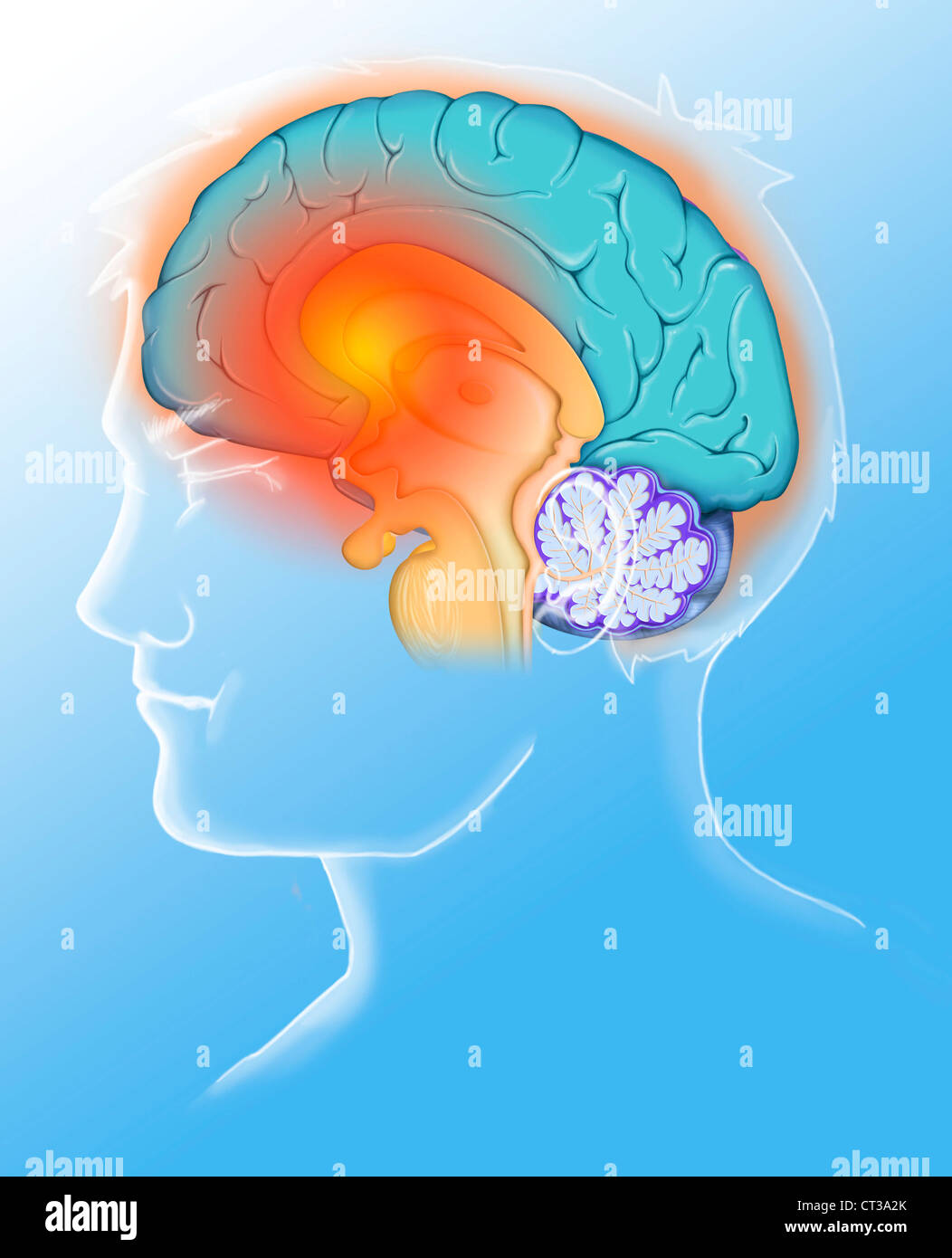 Headache concept drawing hi-res stock photography and images - Alamy