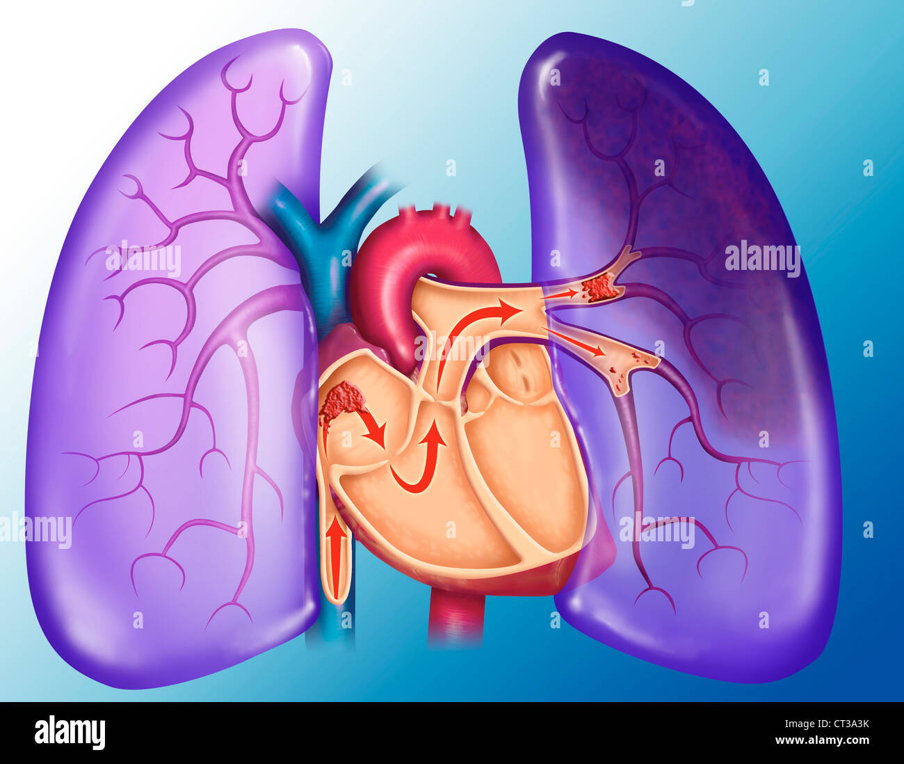 Pulmonary Veins Arteries Stock Photos & Pulmonary Veins Arteries Stock ...