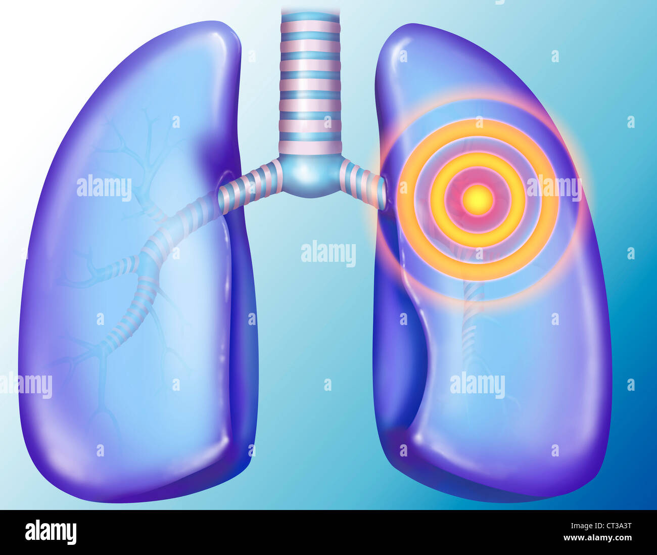 Broncho pulmonary system hi-res stock photography and images - Alamy