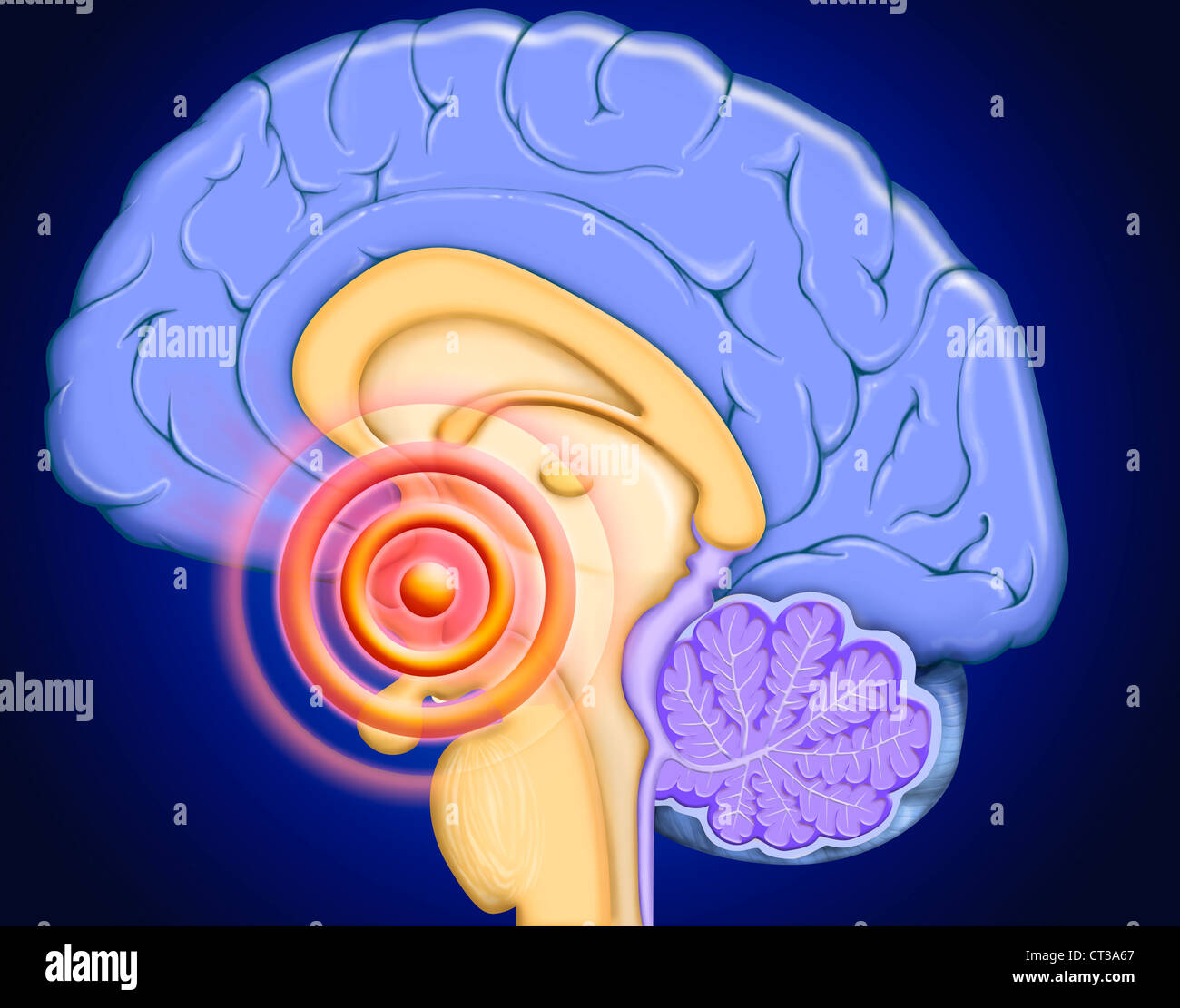 ALZHEIMER'S DISEASE, DRAWING Stock Photo - Alamy