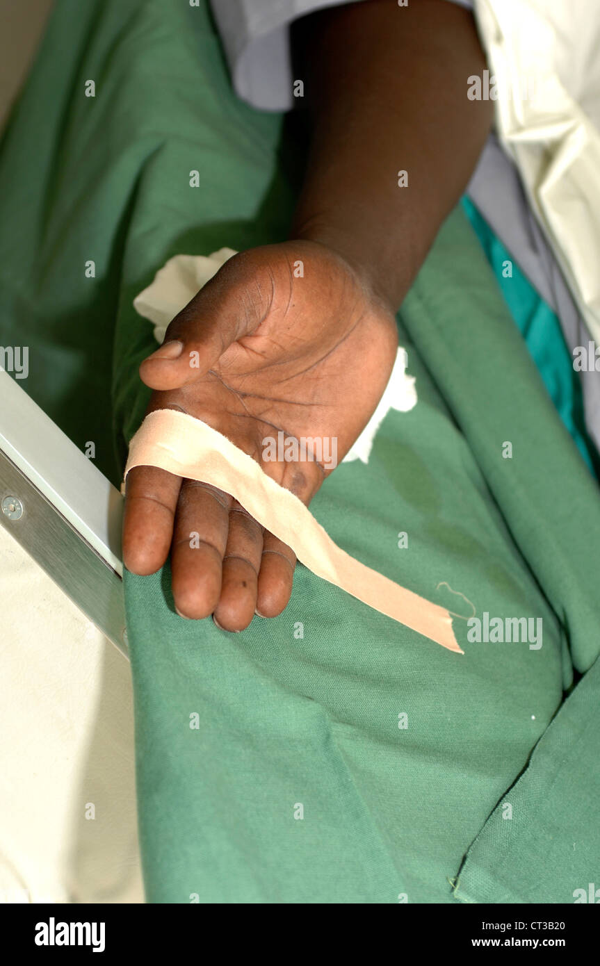 Radial Angiography High Resolution Stock Photography and Images - Alamy