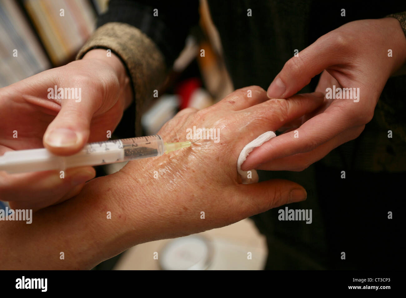 Mesotherapy hands hi-res stock photography and images - Alamy