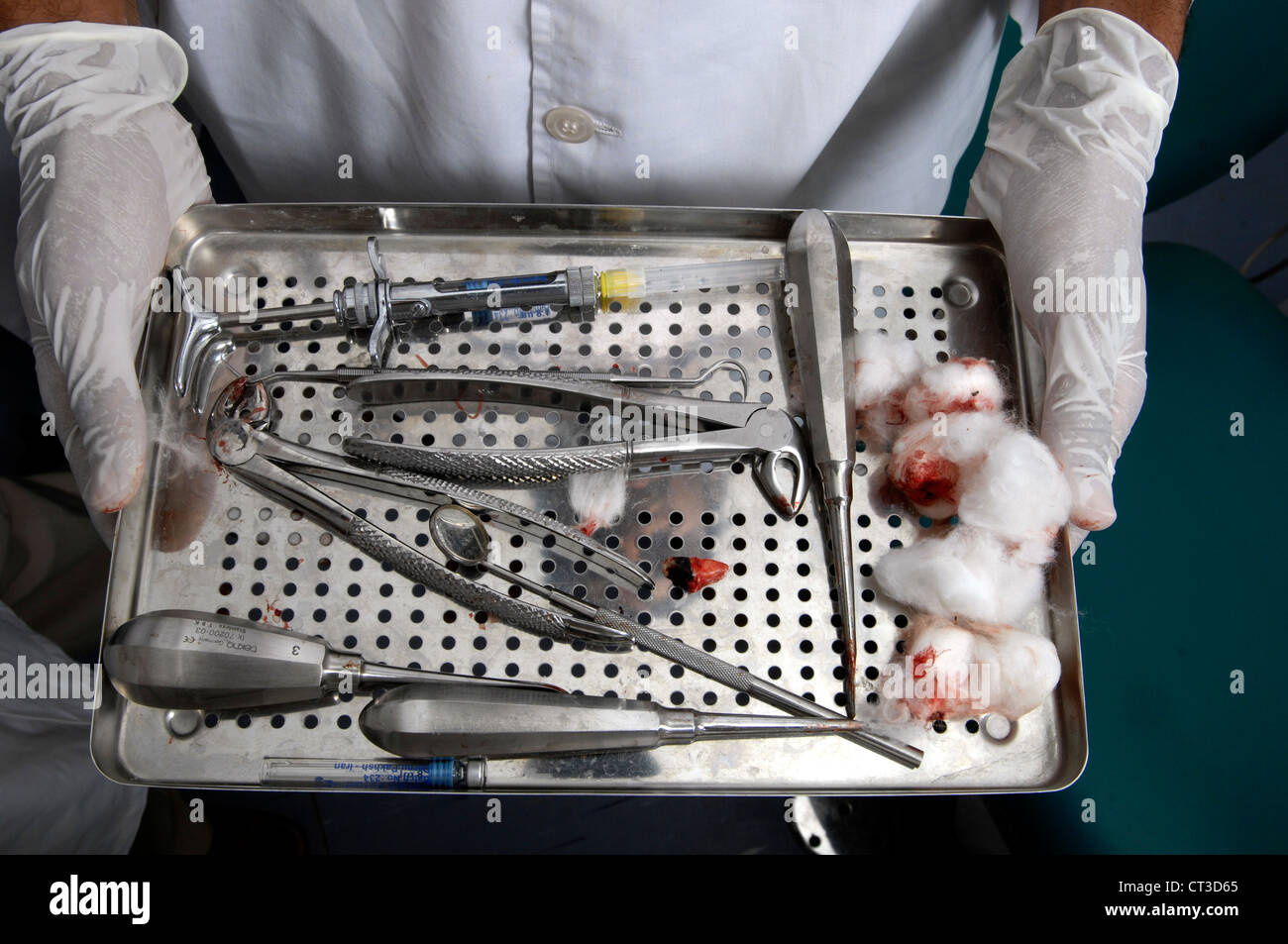 A tray bearing the tools required for tooth extraction including; swabs ...