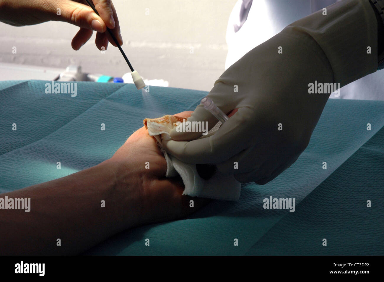 Wound disinfection spray hi-res stock photography and images - Alamy