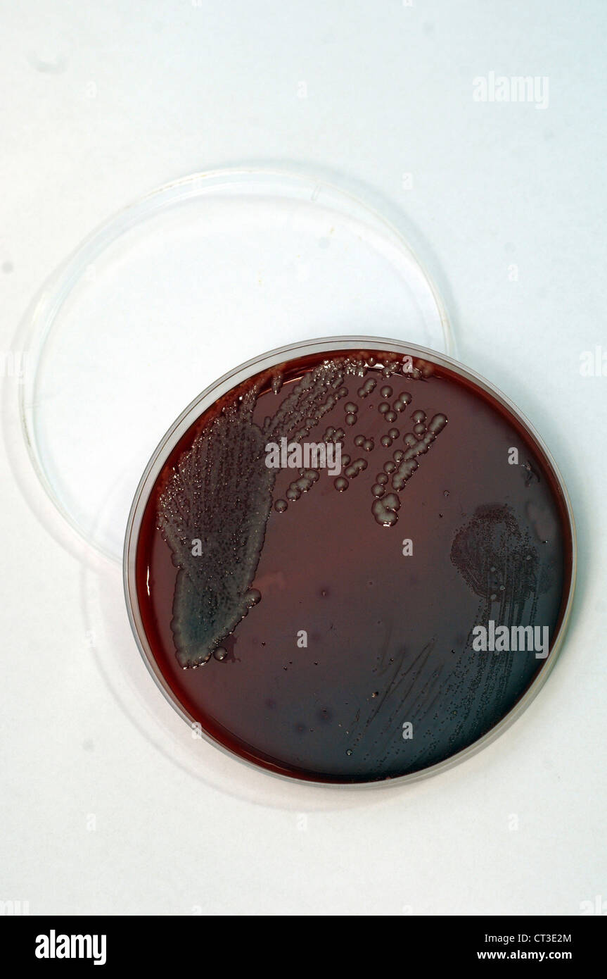 Blood poisoning hi-res stock photography and images - Alamy