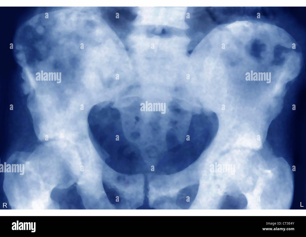 Ilium Stock Photos & Ilium Stock Images - Alamy