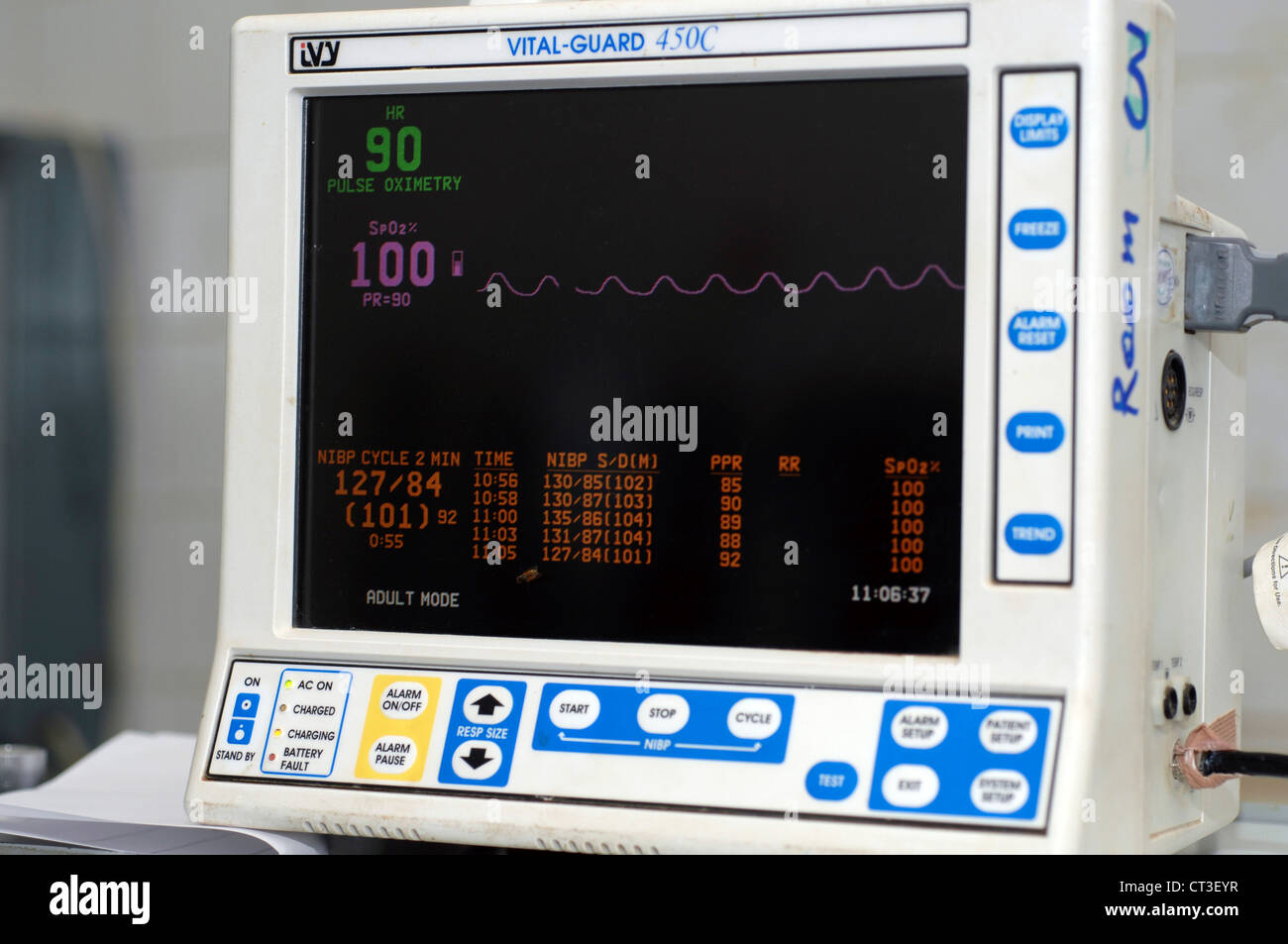 Vital signs monitor used during surgery to supervise patients ...
