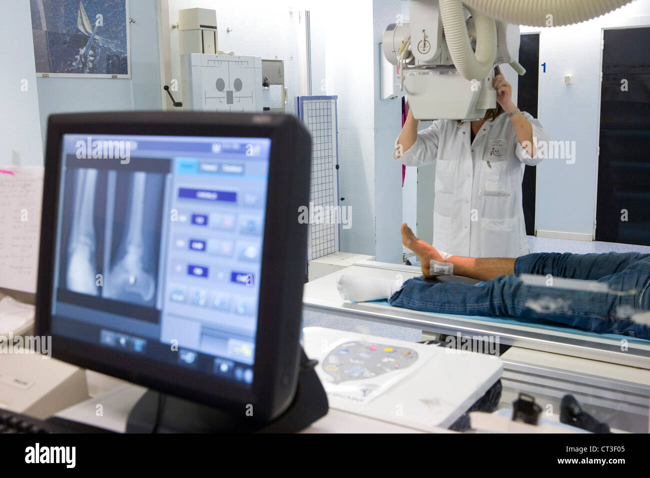Radiography results hi-res stock photography and images - Alamy