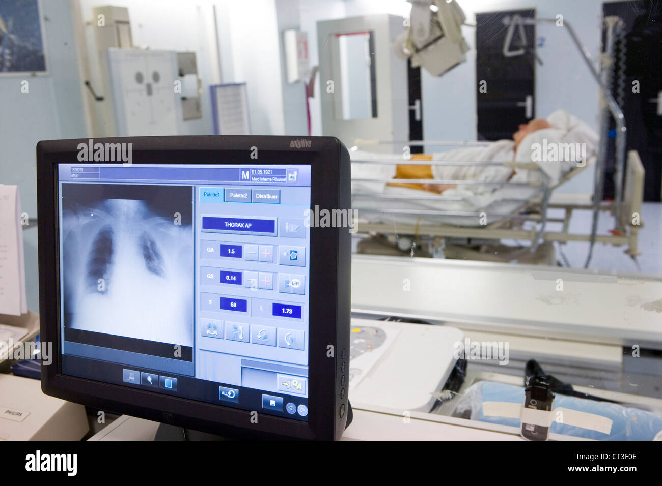 Human lungs radiology exam in hi-res stock photography and images - Alamy