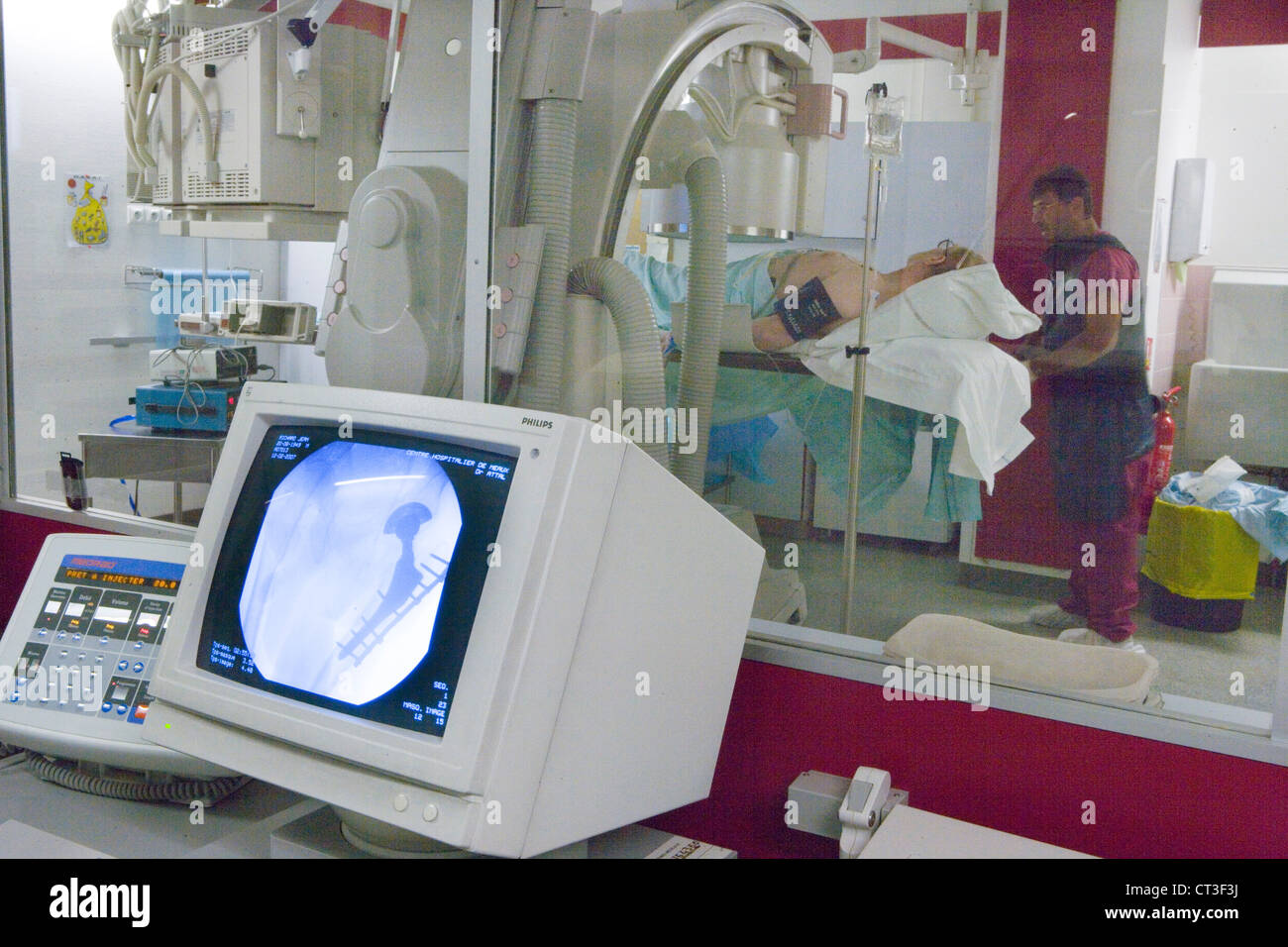 Digital angiography hi-res stock photography and images - Alamy