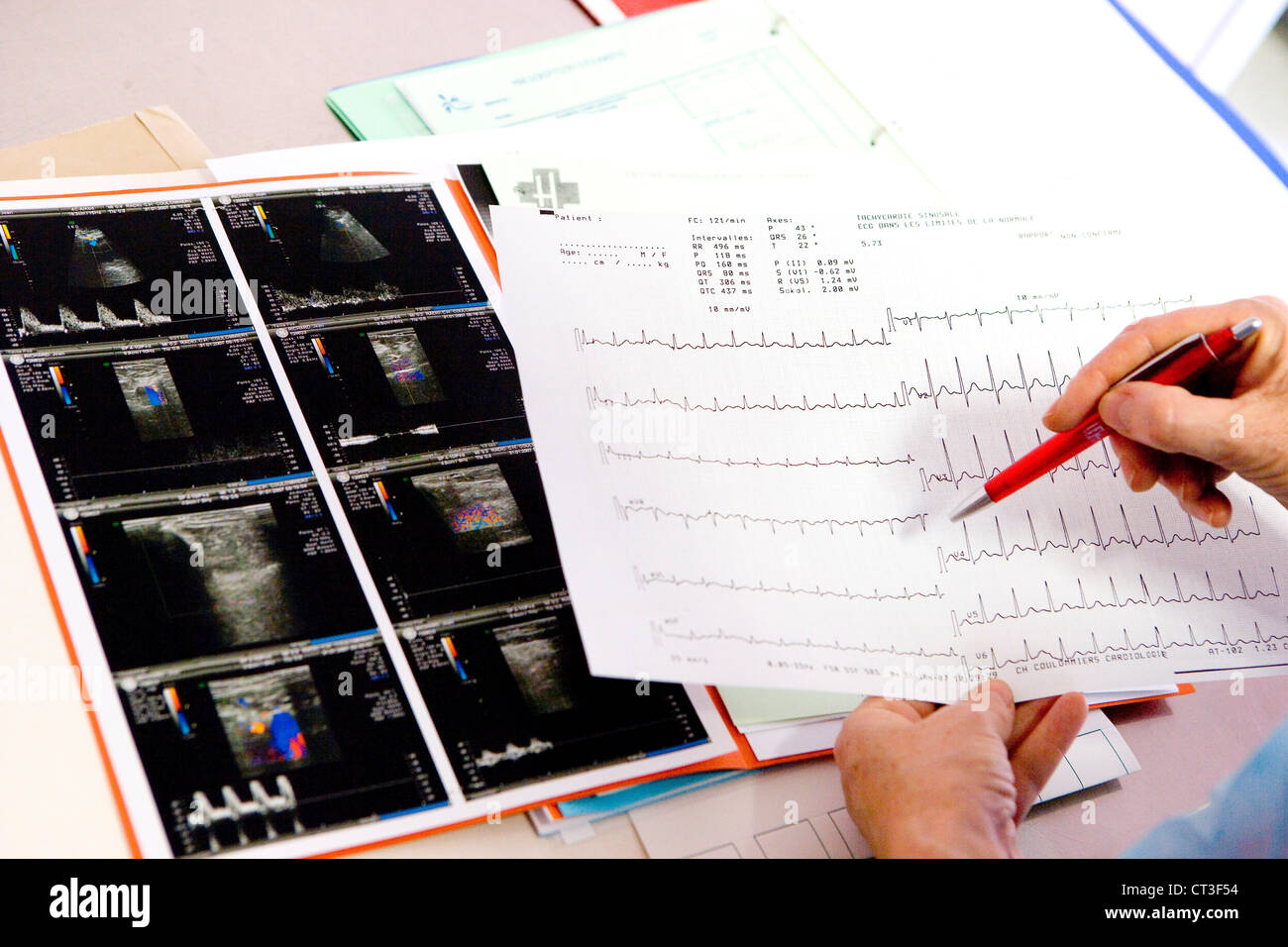 Ecg scan hi-res stock photography and images - Alamy