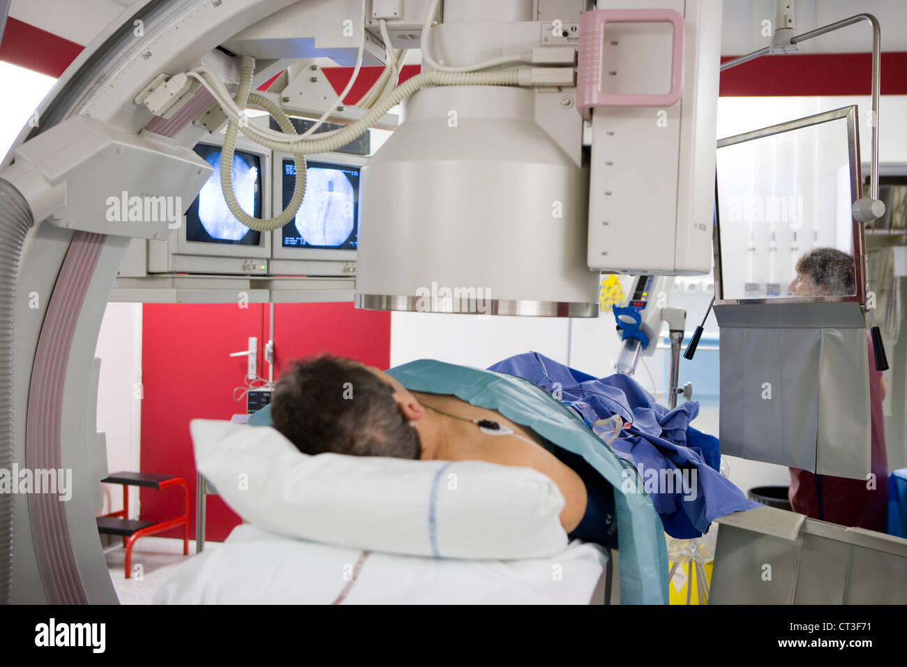 Man angiography hi-res stock photography and images - Alamy
