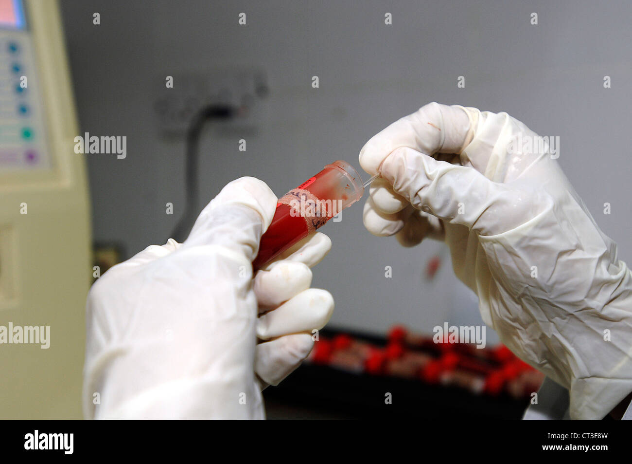A laboratory technician taking cultures from a patient's blood sample ...