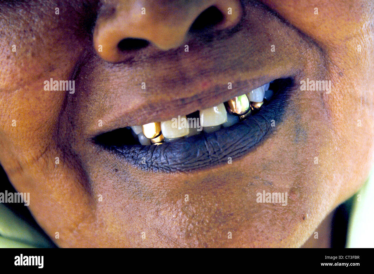 Gold teeth hi-res stock photography and images - Alamy