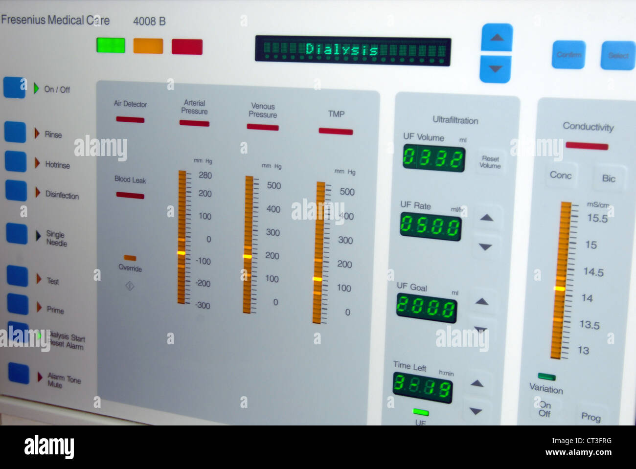 A typical control display for a Hemodialysis Machine Stock Photo - Alamy