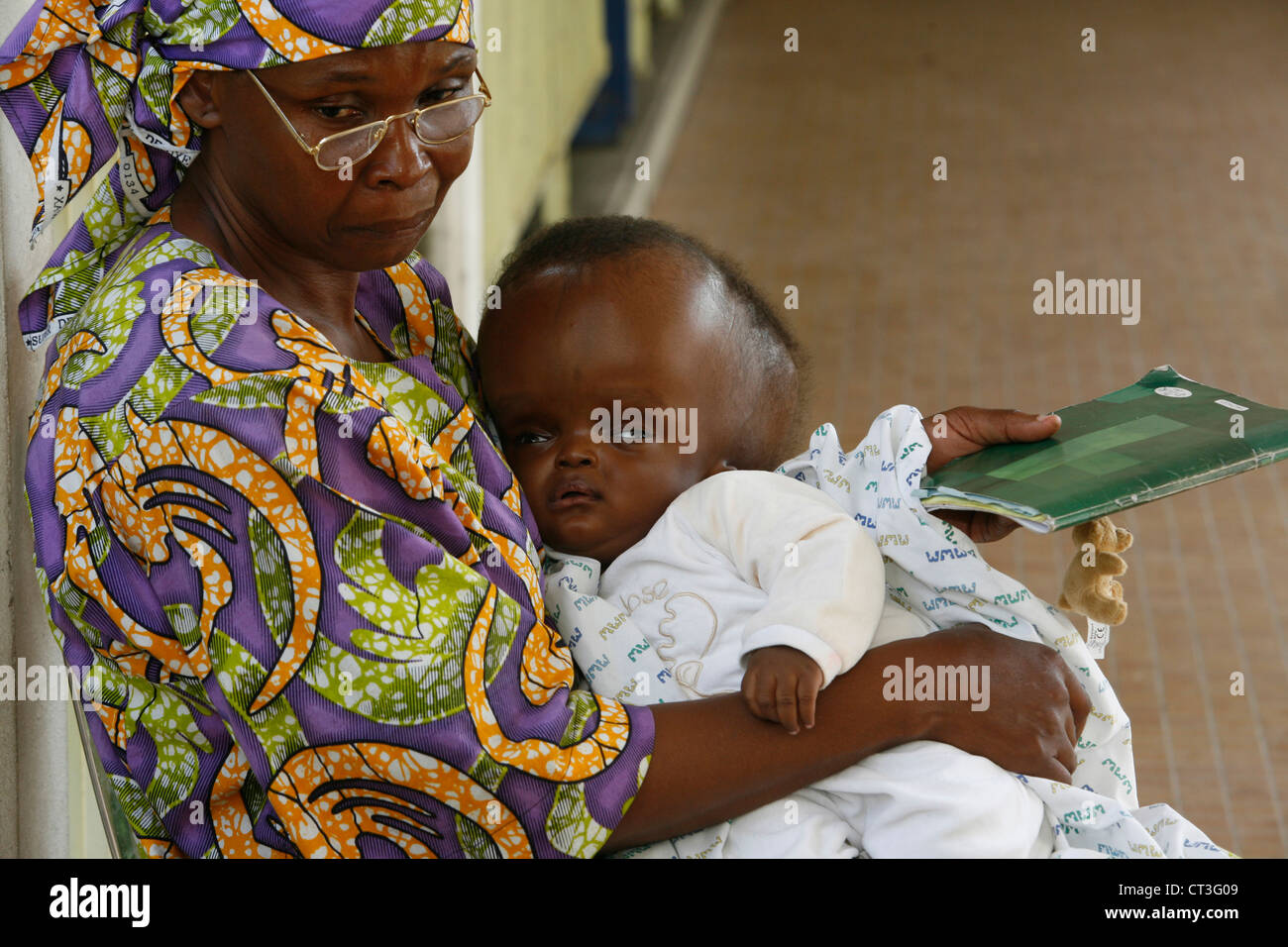 Hydrocephalus hi-res stock photography and images - Alamy
