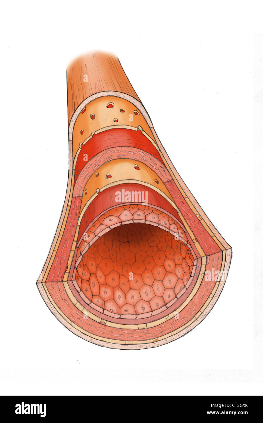 Artery walls hi-res stock photography and images - Alamy