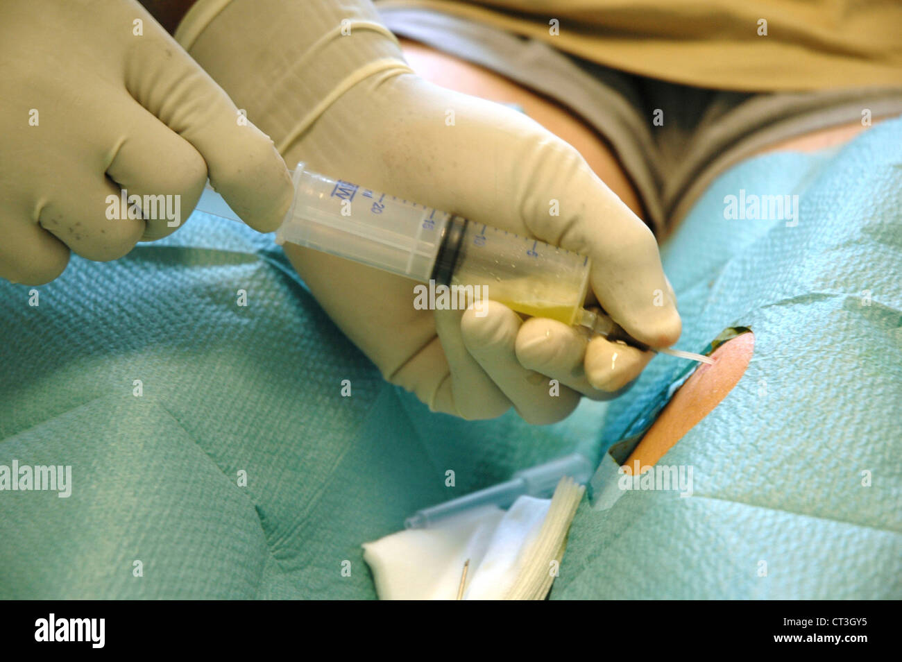 Spinal tap hi-res stock photography and images - Alamy