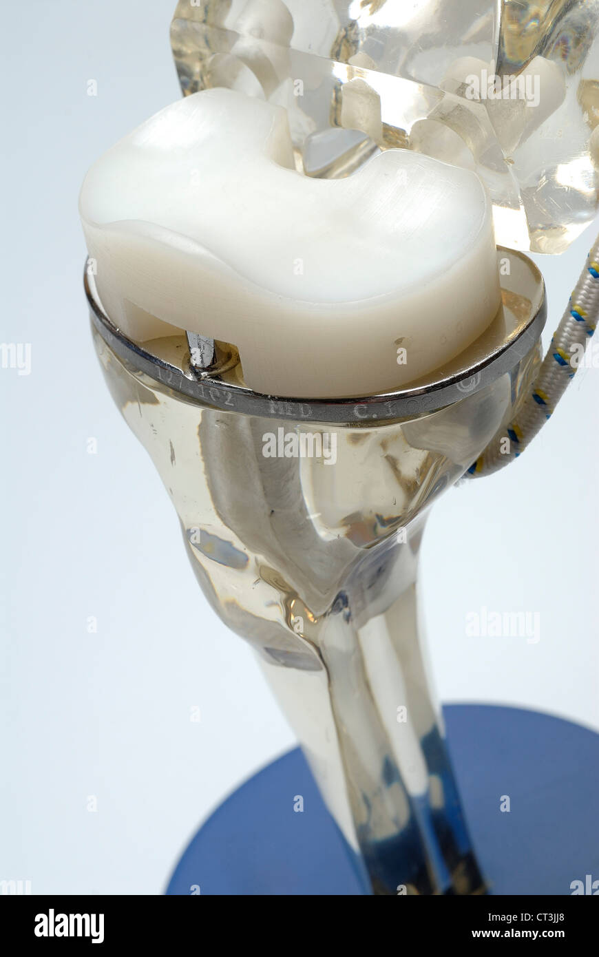 Prosthetic knee joints hi-res stock photography and images - Alamy
