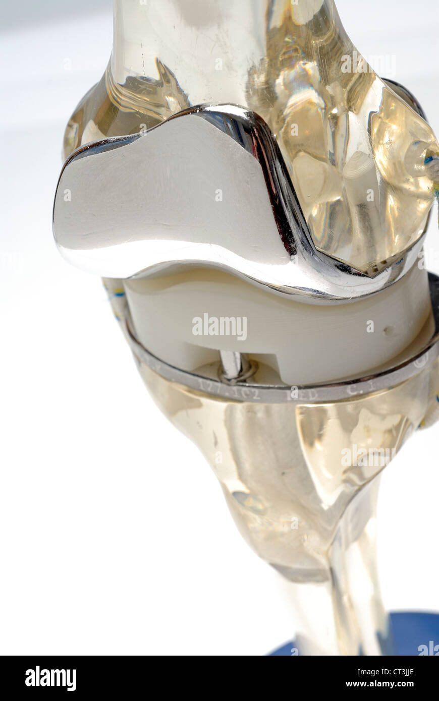 Prosthetic knee joints hi-res stock photography and images - Alamy