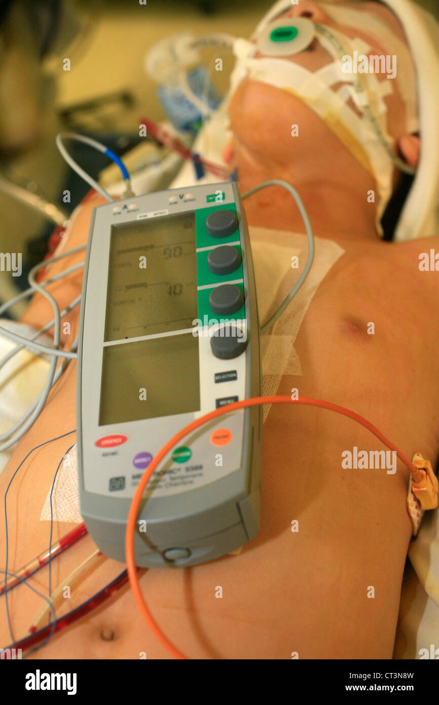 Pacemaker heart hi-res stock photography and images - Alamy