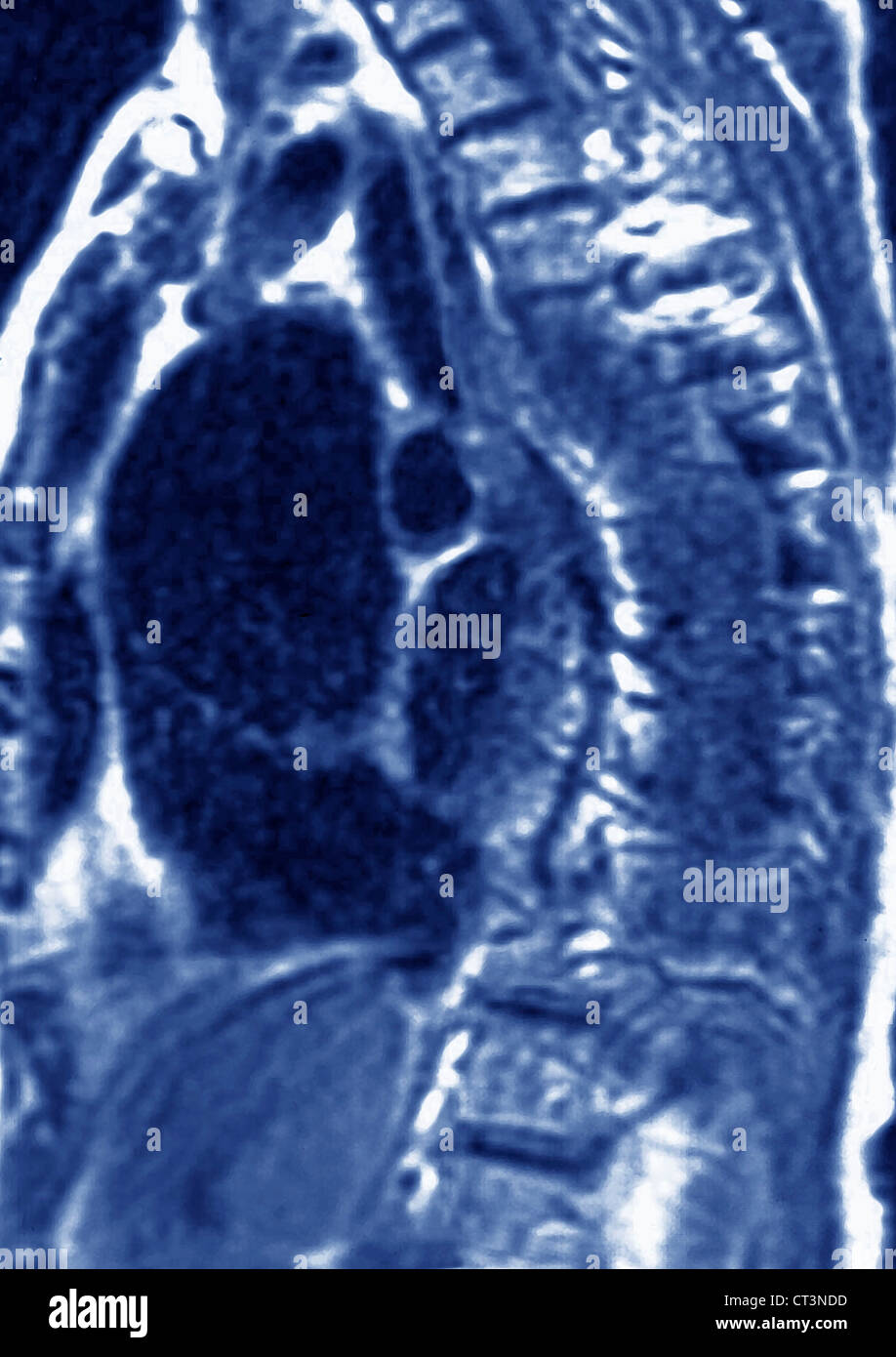 Cardiac Mri High Resolution Stock Photography and Images - Alamy