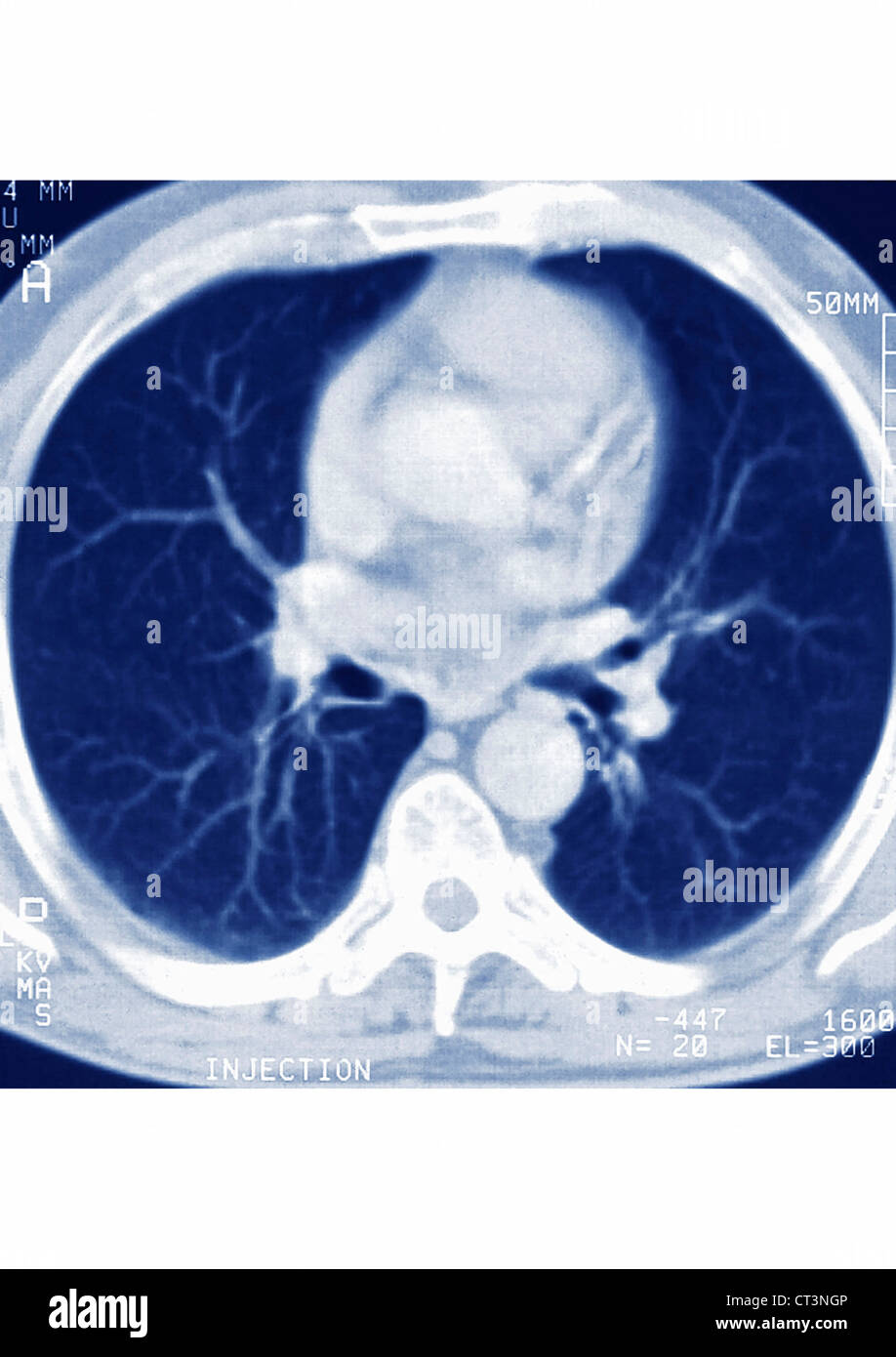 Cardiac mri hi-res stock photography and images - Alamy