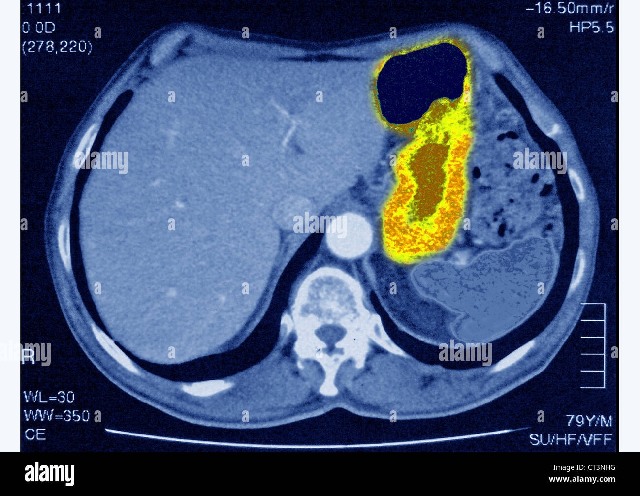Stomach scan hi-res stock photography and images - Alamy