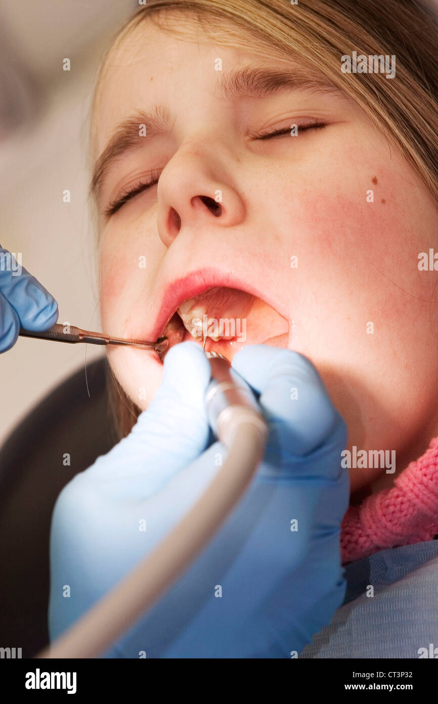 Child dental surgery hi-res stock photography and images - Alamy