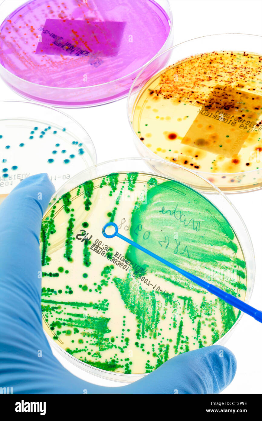 Microbes cultured hi-res stock photography and images - Alamy