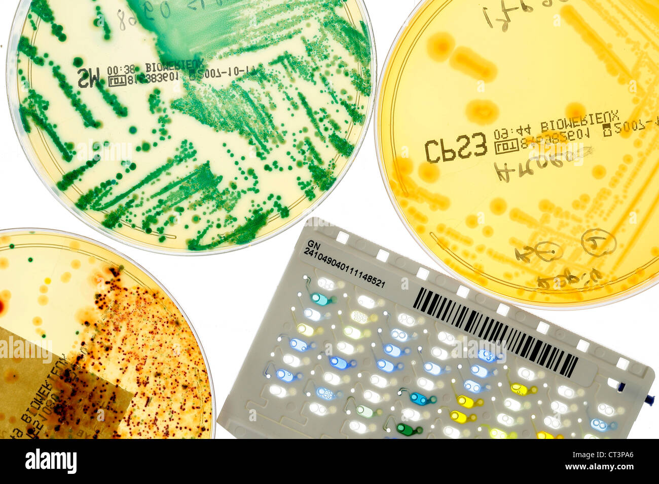 Vitek analysis hi-res stock photography and images - Alamy