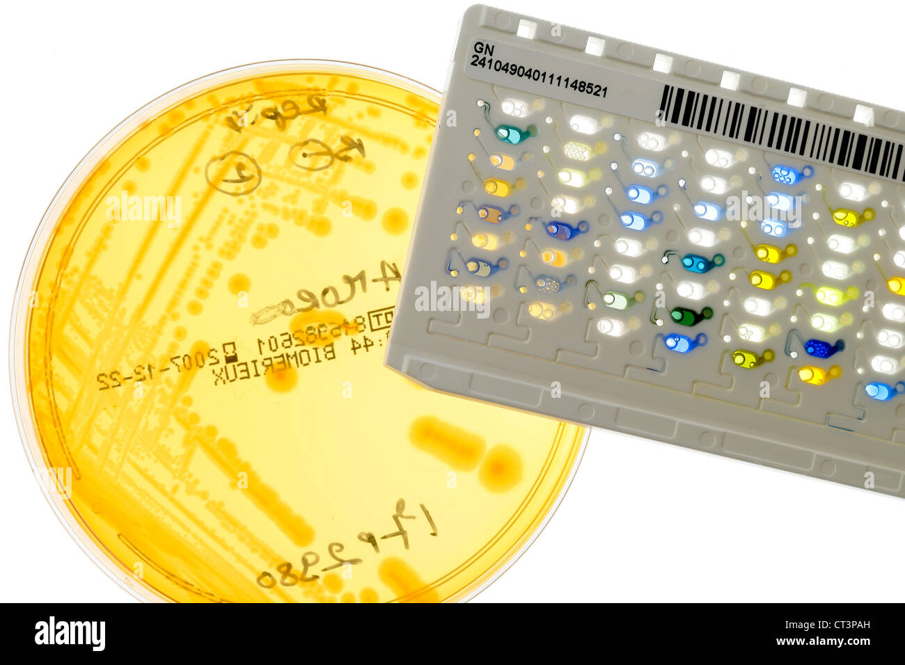 Vitek analysis hi-res stock photography and images - Alamy