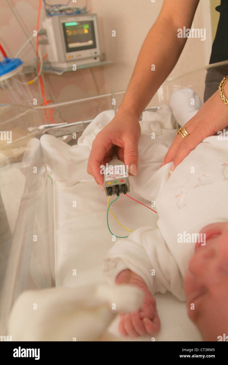 Ecg Holter Stock Photos & Ecg Holter Stock Images - Alamy