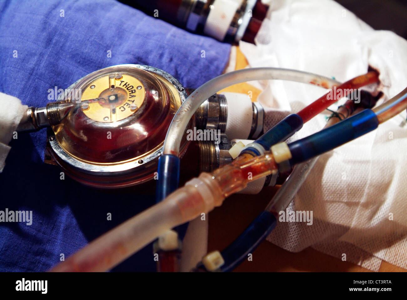 Ventricular assist device hi-res stock photography and images - Alamy