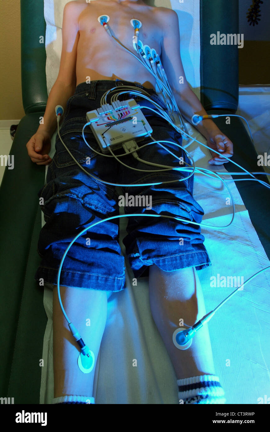 ECG OF AN ADOLESCENT Stock Photo - Alamy