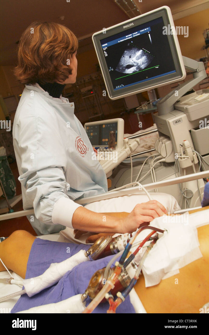 Ventricular assist device hi-res stock photography and images - Alamy