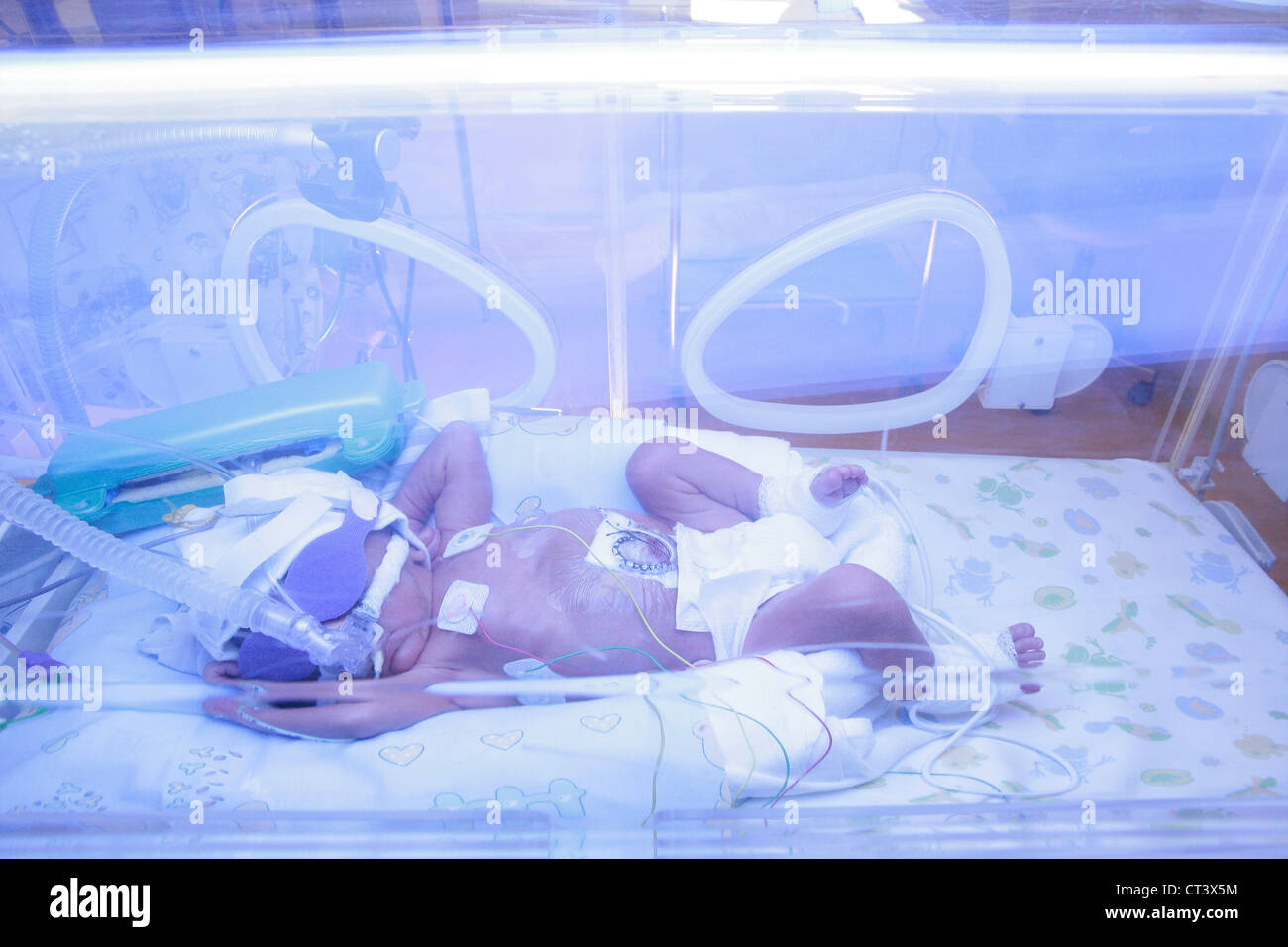 Neonatorum hi-res stock photography and images - Alamy