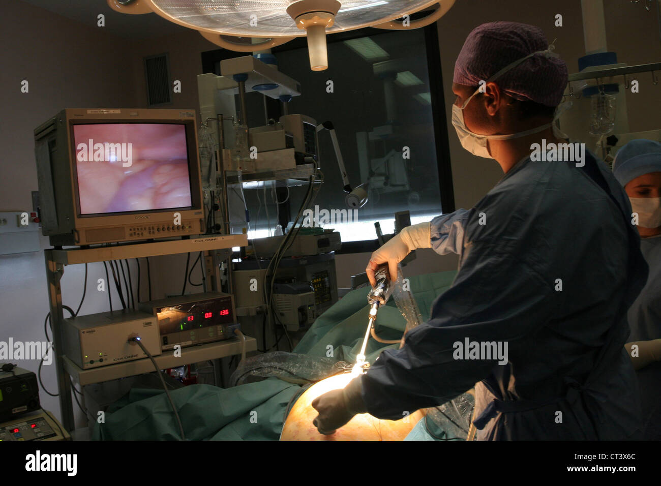 Laparoscopic surgery colon hi-res stock photography and images - Alamy