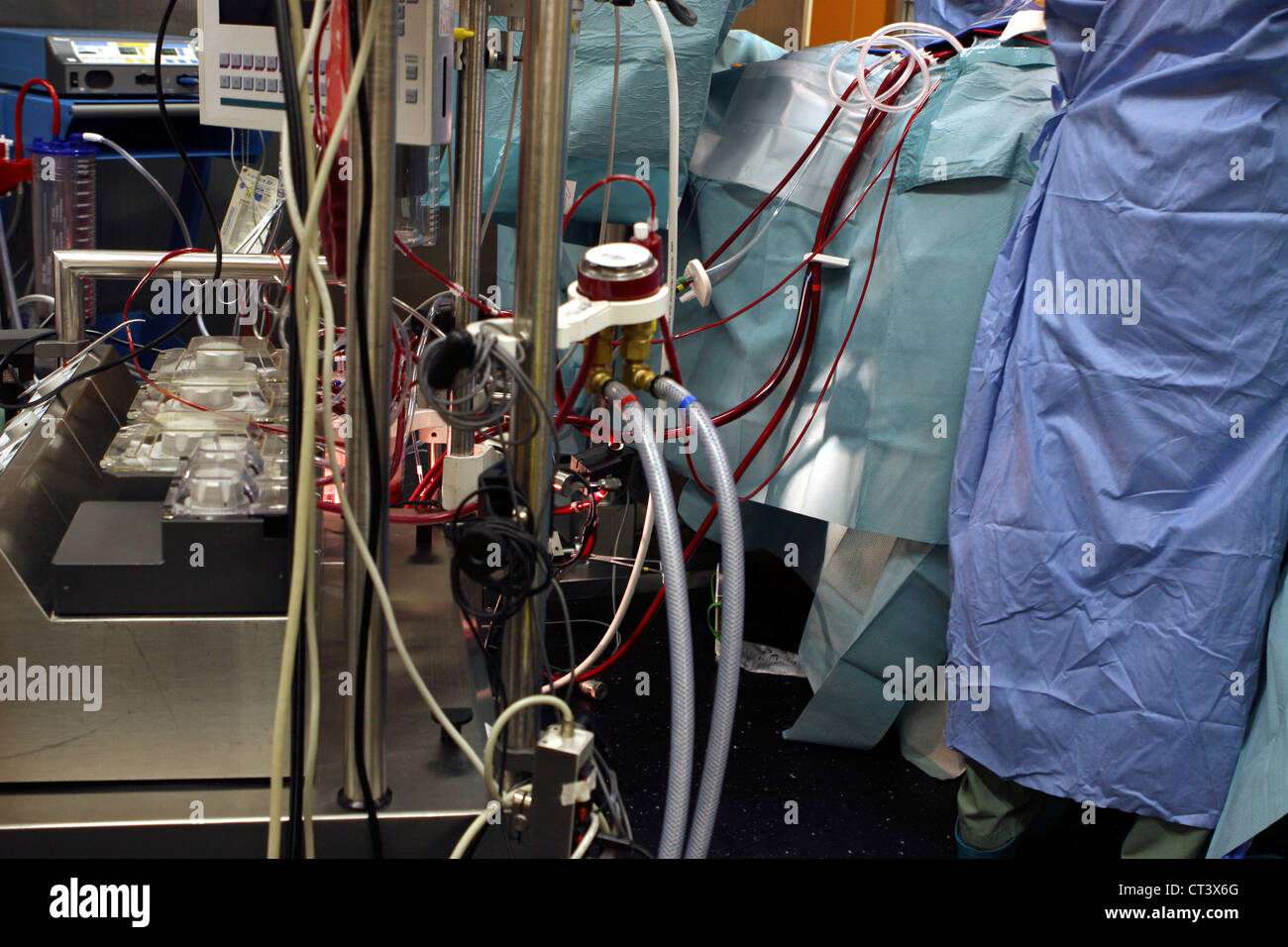 Cardiopulmonary Bypass Machine High Resolution Stock Photography and ...