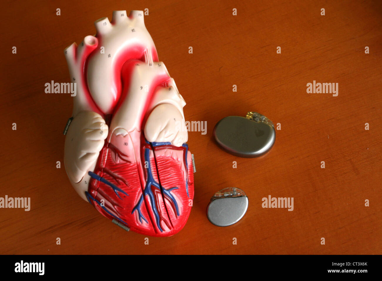 Implantable cardioverter defibrillators hi-res stock photography and ...