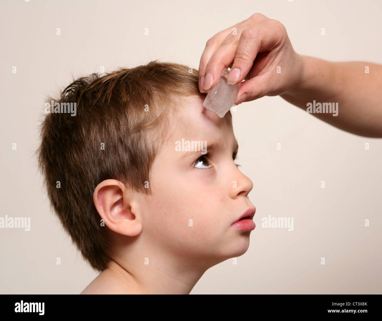 TREATMENT USING ICE Stock Photo - Alamy