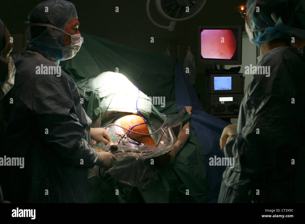 Shoulder joint endoscopy hi-res stock photography and images - Alamy