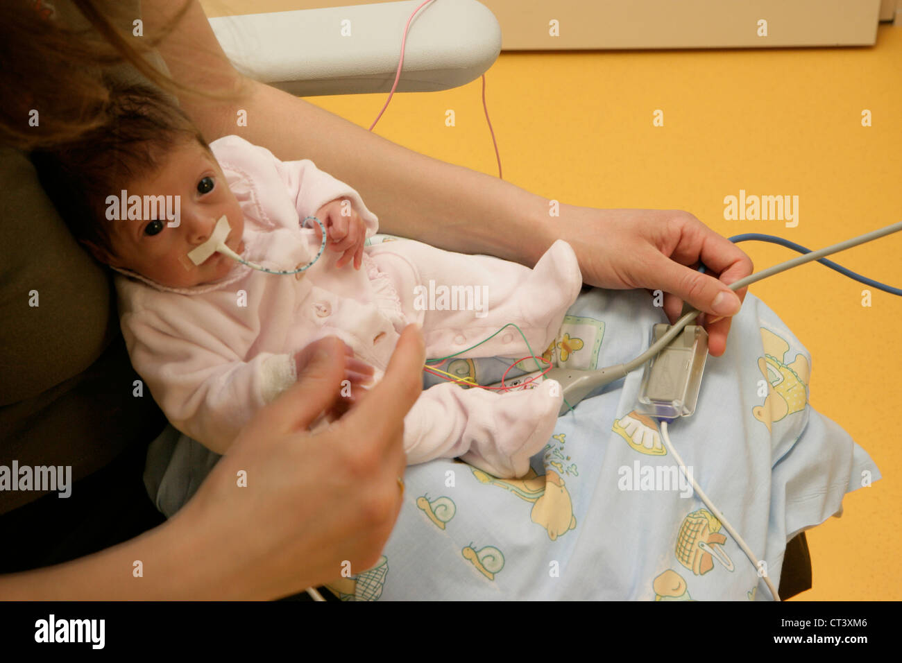 Enteral feeding tubes hi-res stock photography and images - Alamy