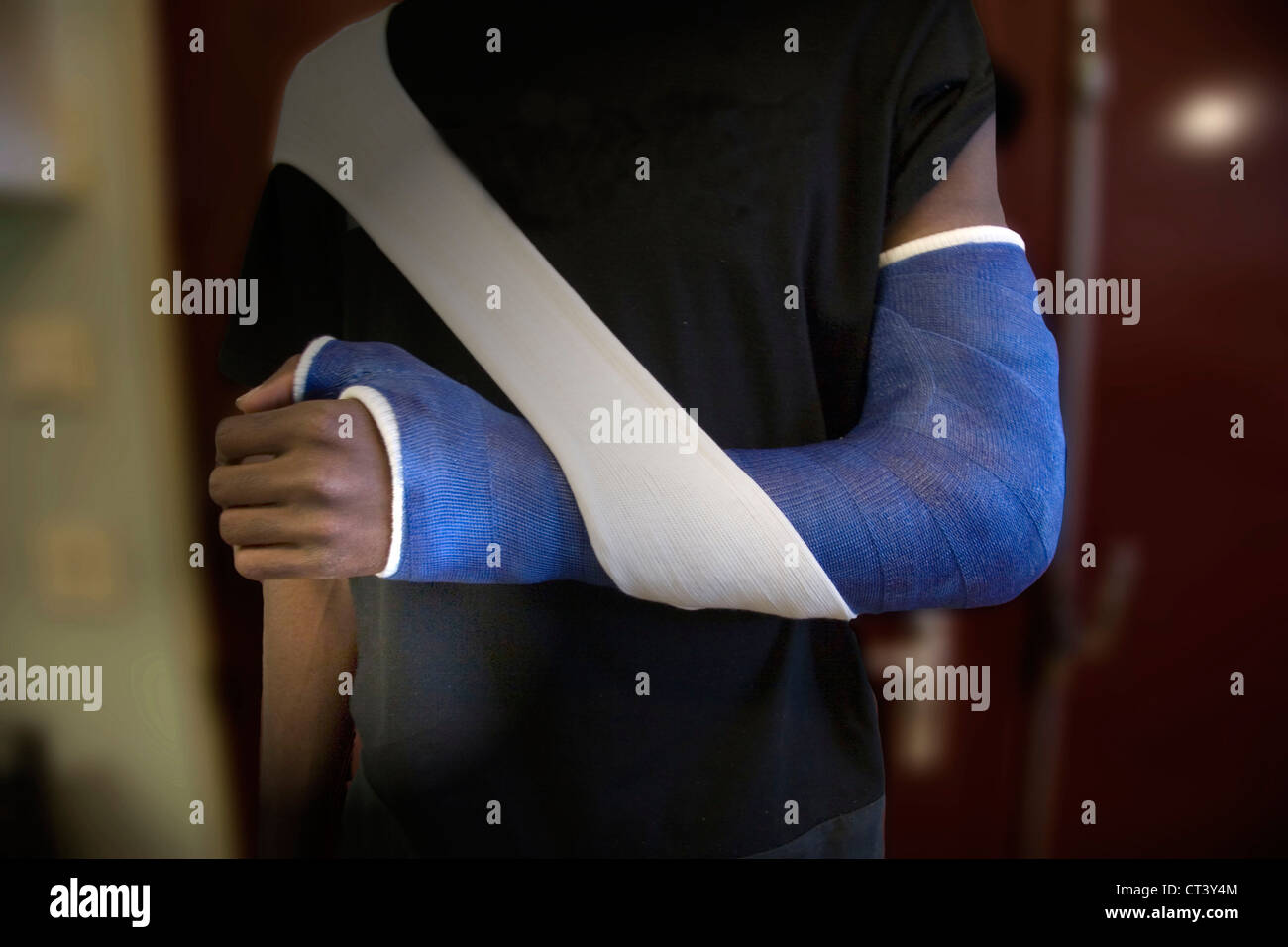 Both arms casts hi-res stock photography and images - Alamy
