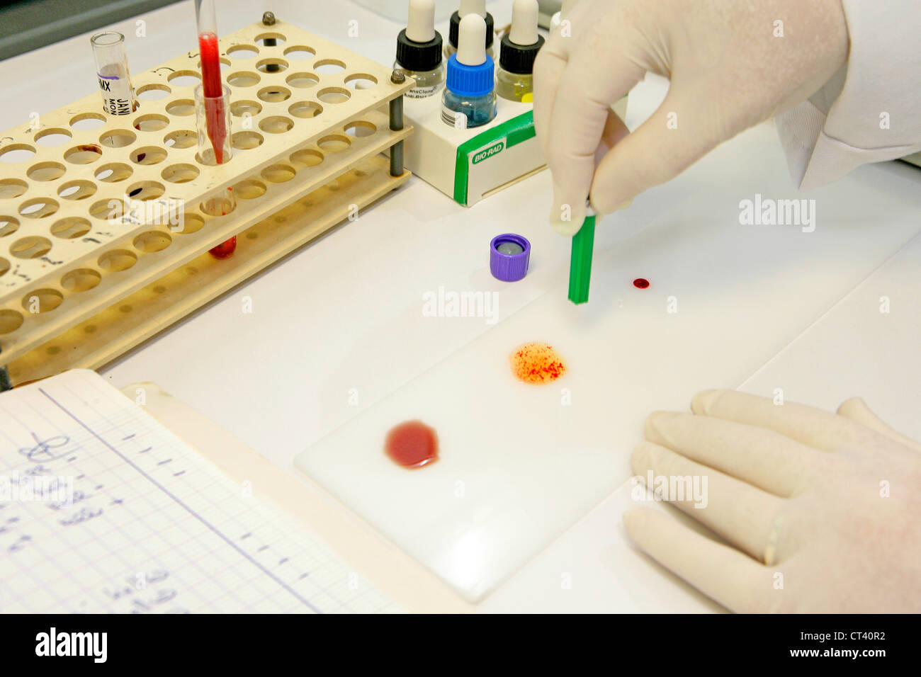 Abo blood type testing hi-res stock photography and images - Alamy