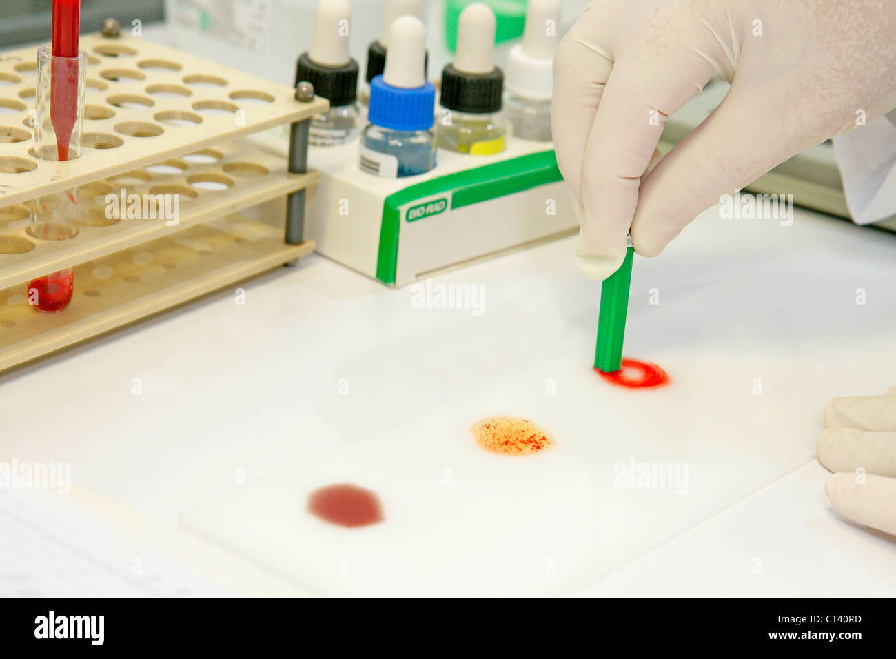 Abo blood type testing hi-res stock photography and images - Alamy