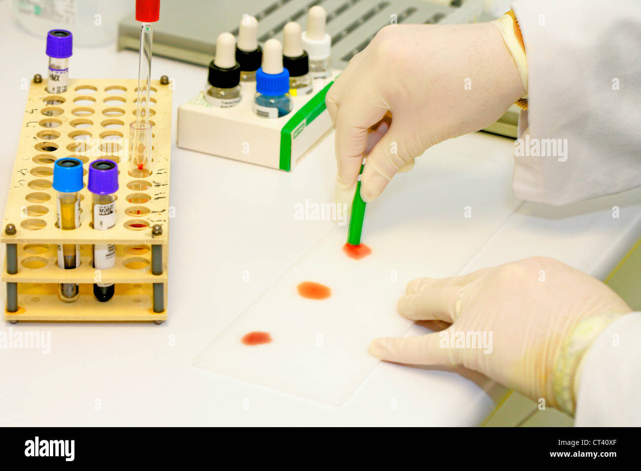 Abo blood type hi-res stock photography and images - Alamy