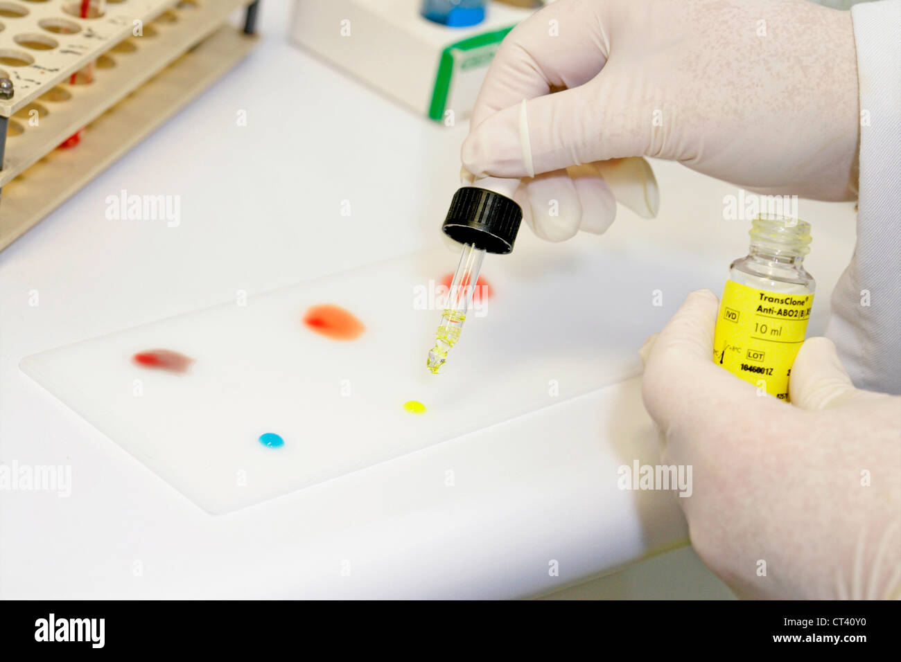 Abo blood type testing hi-res stock photography and images - Alamy