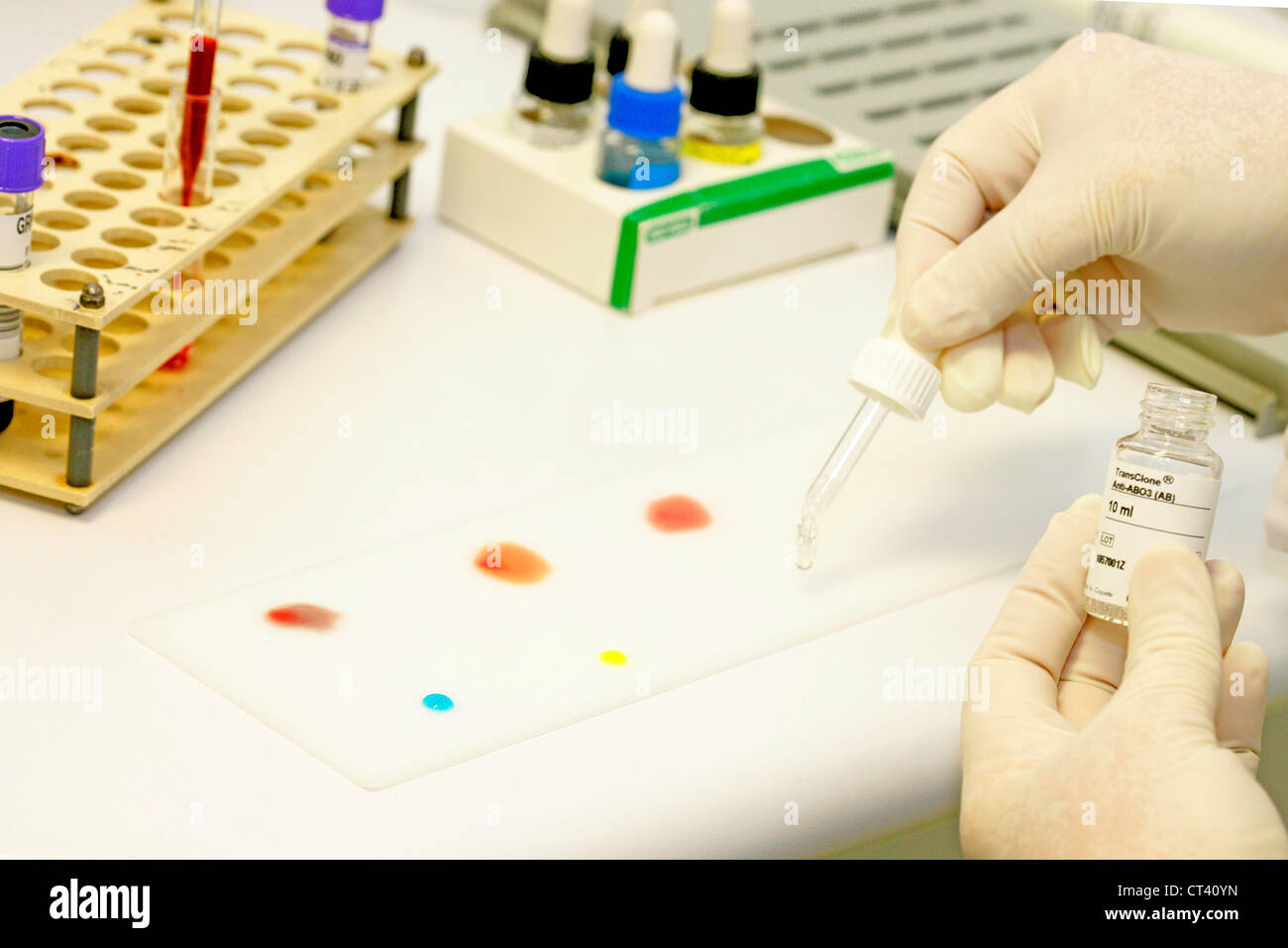 Abo blood type testing hi-res stock photography and images - Alamy