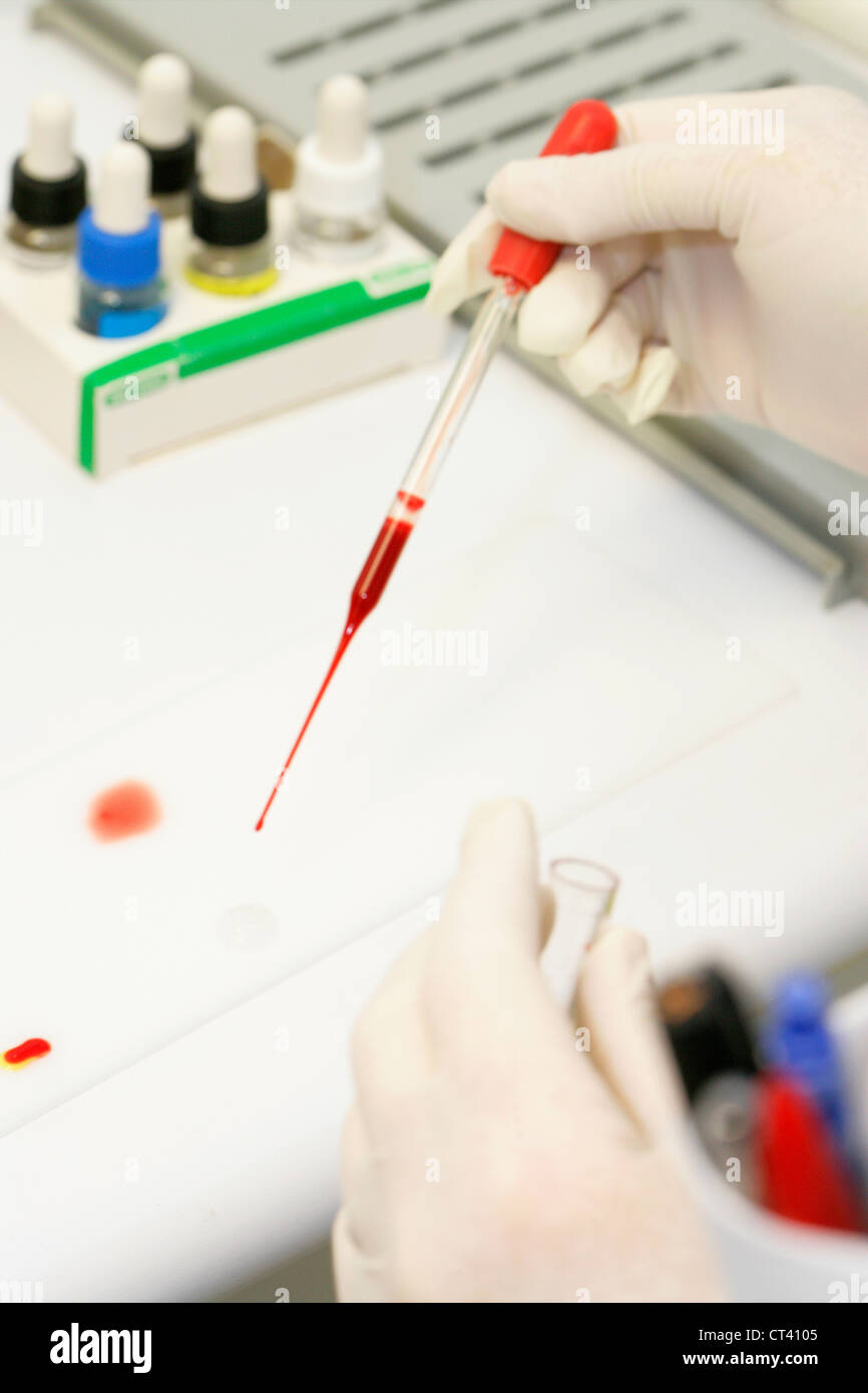 Abo blood type testing hi-res stock photography and images - Alamy